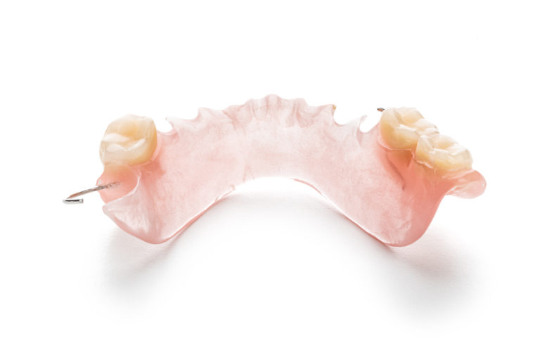 Próteses removiveis | Implantes Dentários